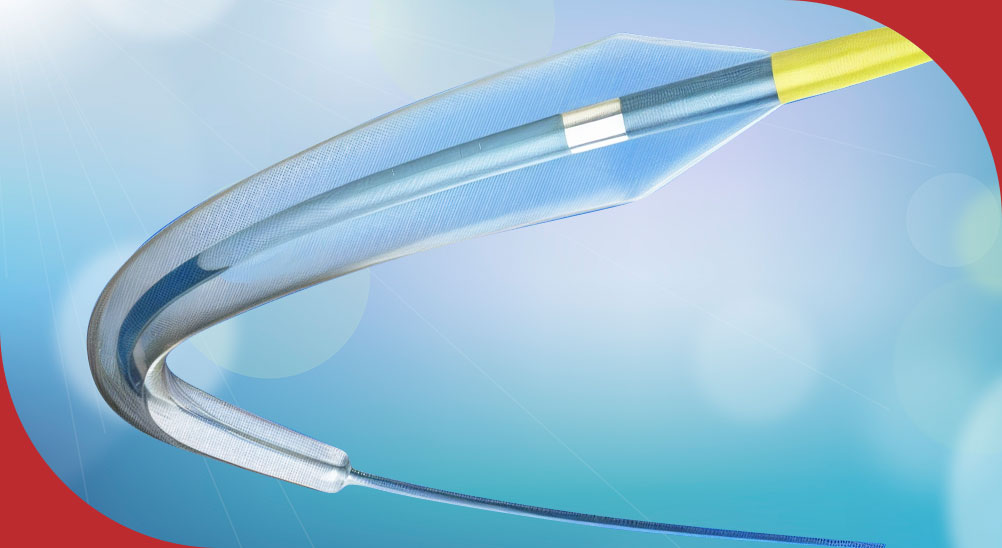 3V Paulo – S3V Vascular Technologies